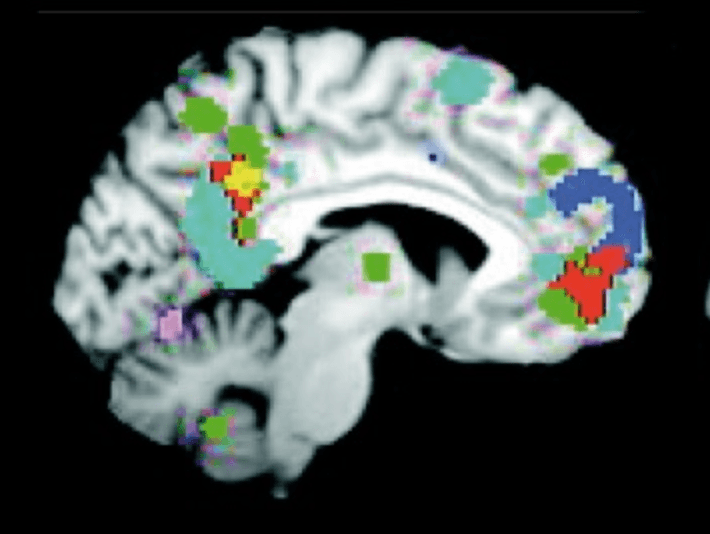 The brain's default network: origins and implications for the study of ...