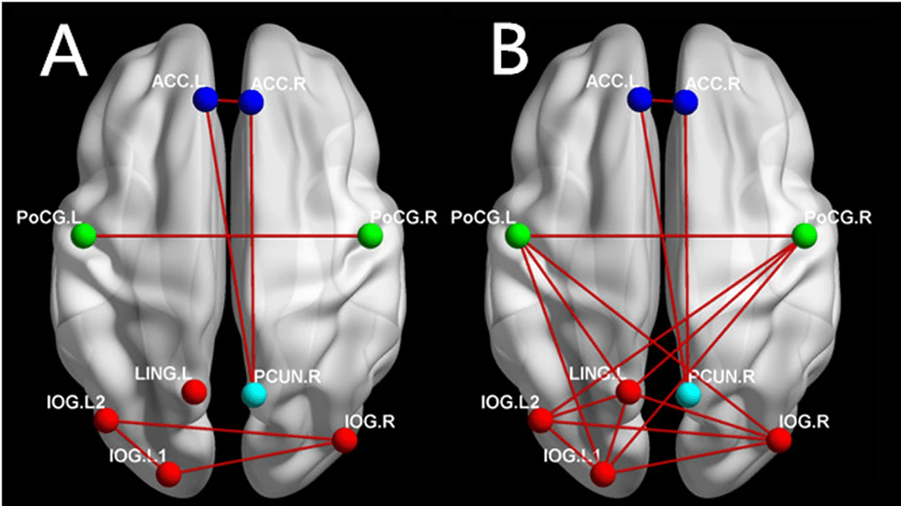 The Brain Functional State of Music Creation: an fMRI Study of ...